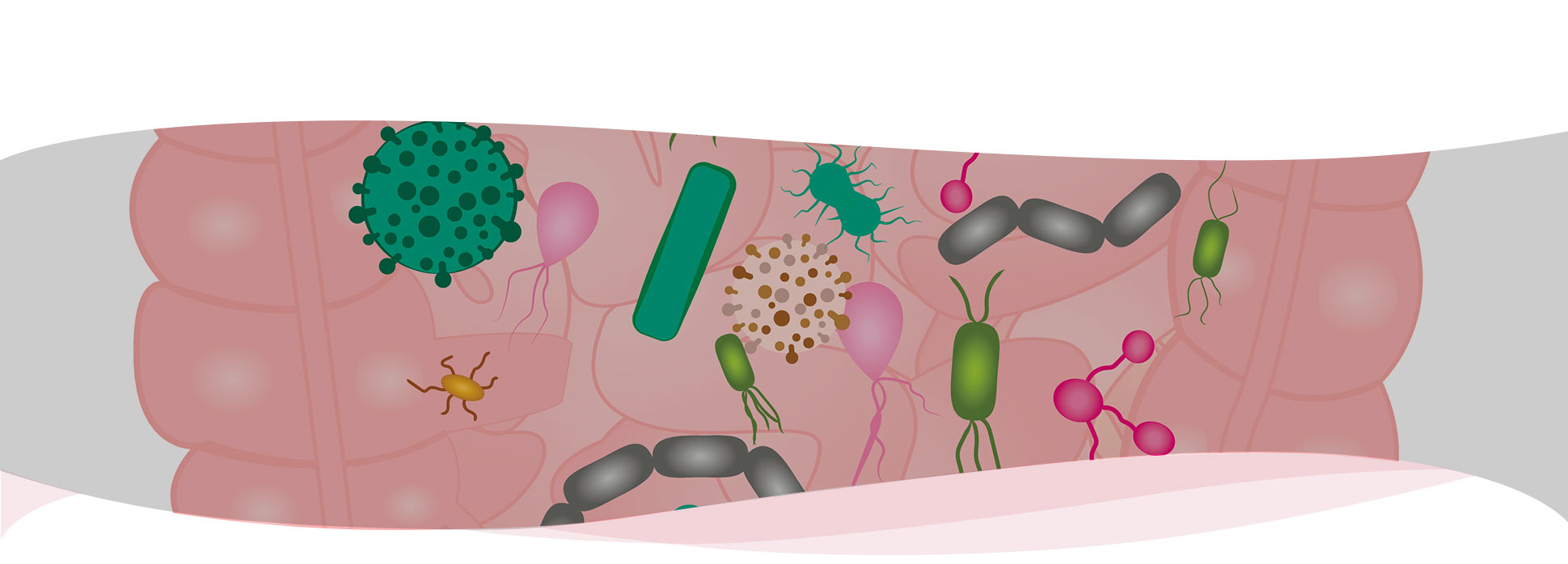 Small Intestinal Bacterial Overgrowth | Rory Hornstein RD | 403-819-6919